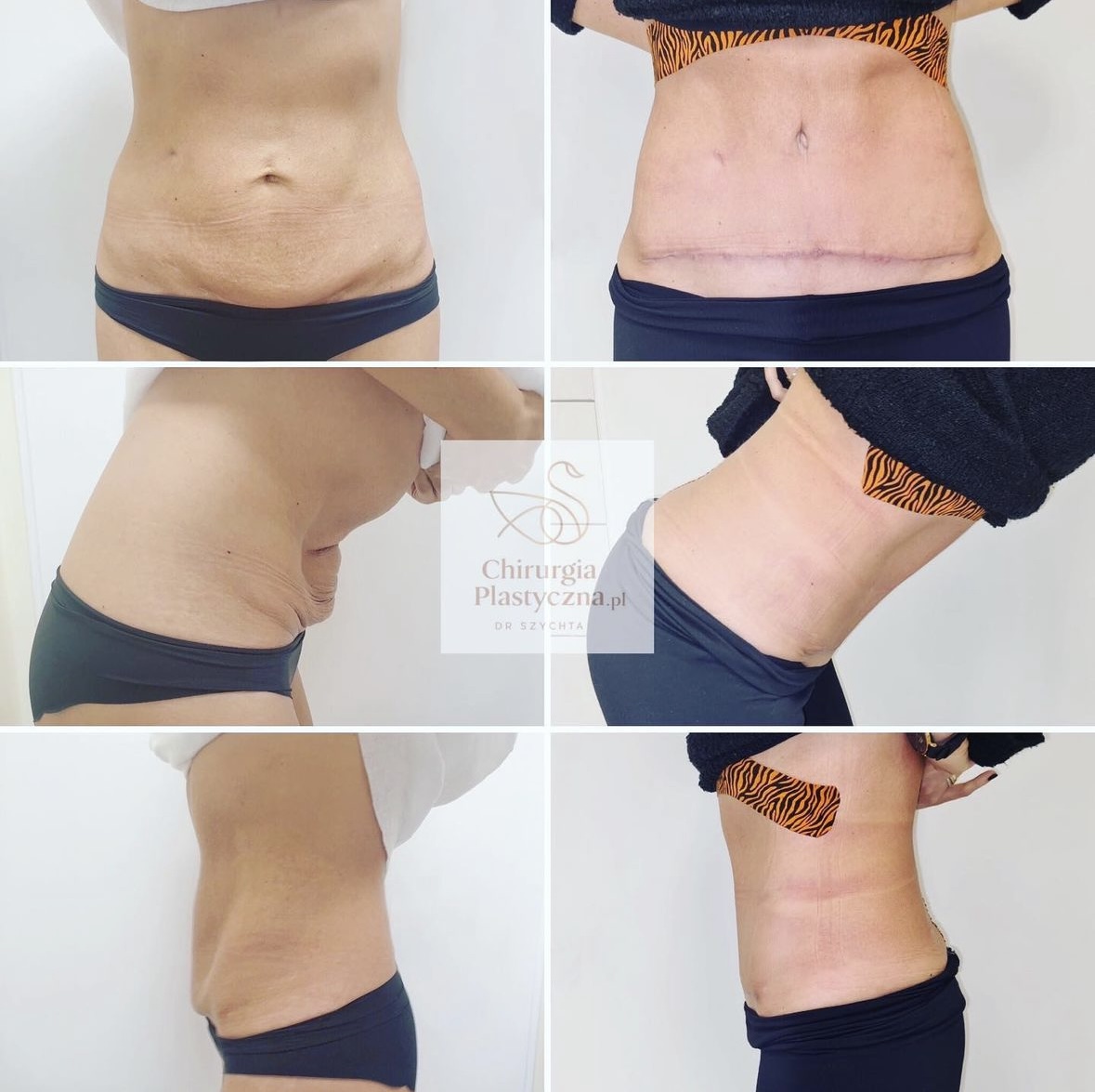 Chirurgia plastyczna